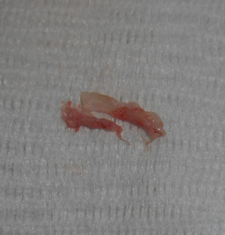 Ultrasonographic diagnosis of meniscal tears in dogs – Vet Practice Support