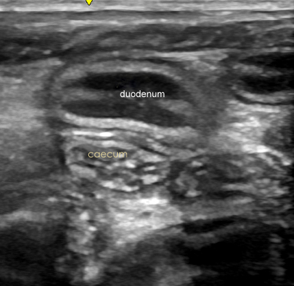 Ultrasonography of the canine and feline caecum (or cecum) – Vet ...