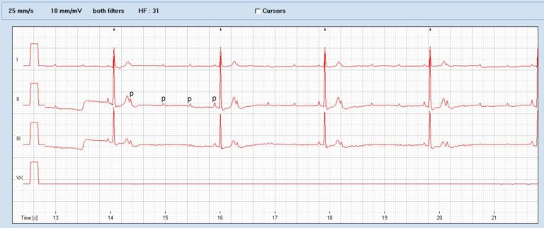 Diastolic mitral regurgitation in canine heart block – Vet Practice Support