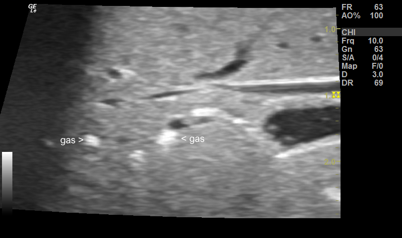 Aerobilia in a cat with extrahepatic biliary obstruction – Vet Practice ...