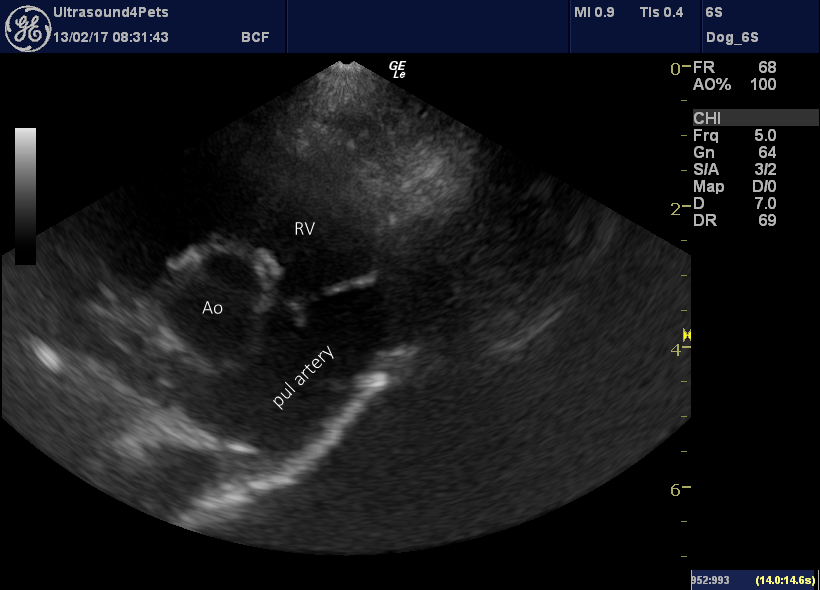 PDA with pulmonary hypertension in an adult dog: difficult decision ...