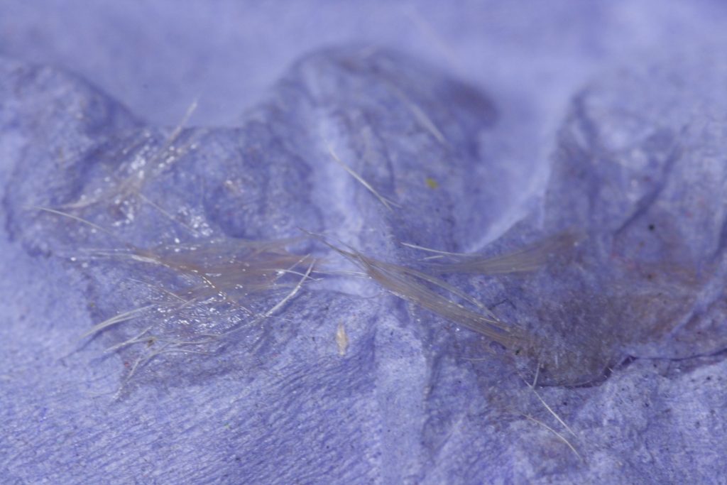 Embedded hairs as a cause of deep pyoderma in short-haired dogs – Vet ...