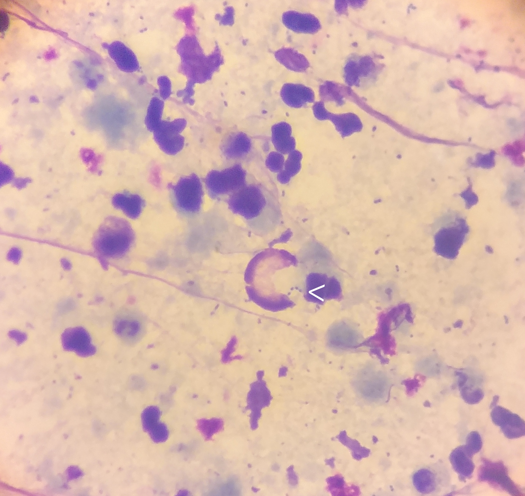 Anal sac ultrasound in dogs: a case of emphysematous anal sacculitis ...