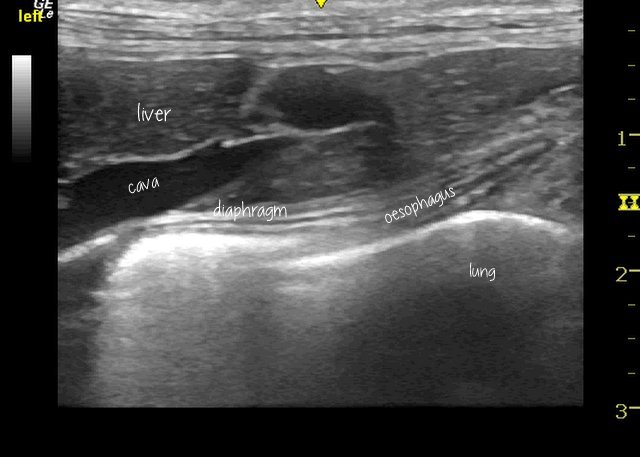 Ultrasound of the canine and feline oesophagus – Vet Practice Support