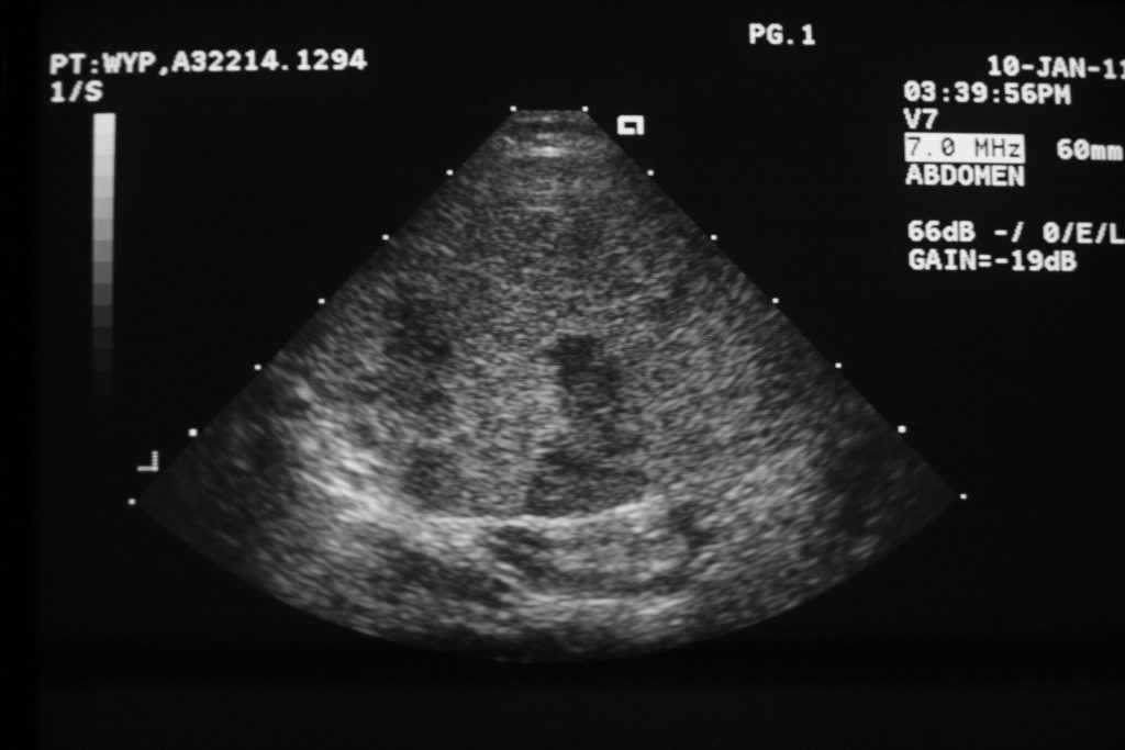 Canine infective endocarditis: observations on presentation, incidence ...