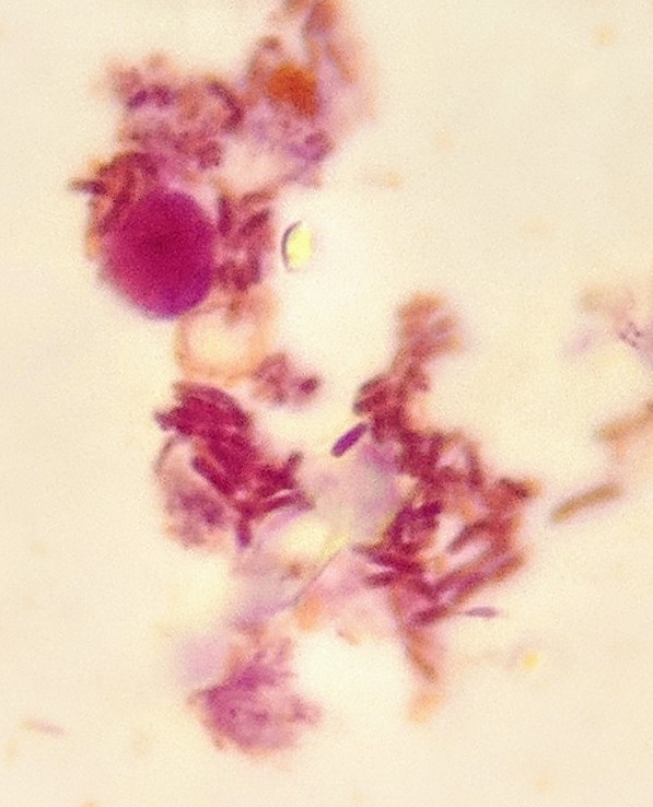 Pyelonephritis in cats and dogs: sonography and management – Vet ...