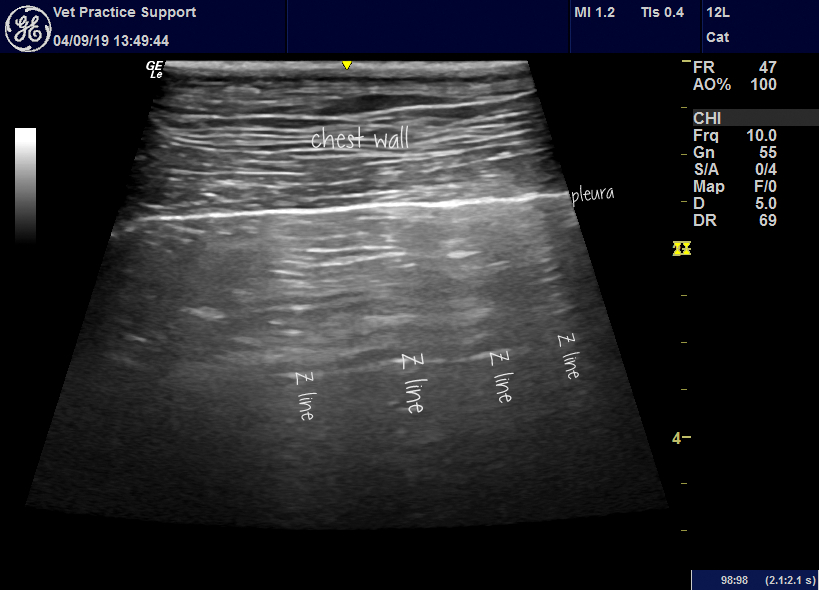 Lung ultrasound: contusions, interstitial syndrome, A, B, C, E, I and Z ...