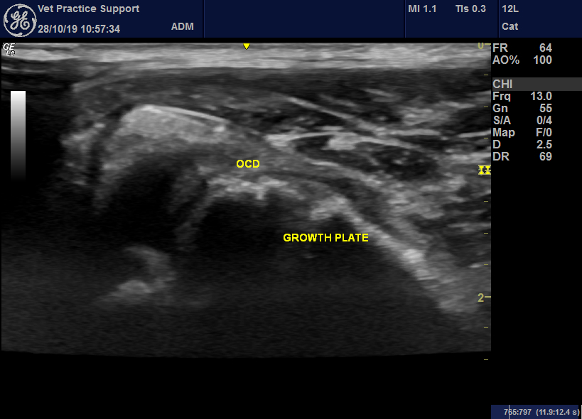Sonographic features of canine shoulder osteochondrosis (OCD) – Vet ...