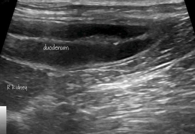 Finding the Ileo-caeco-colic junction on abdominal sonography in dogs ...