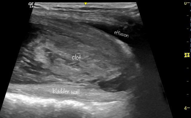 Sonographic manifestations of bleeding disorders in dogs: including a ...