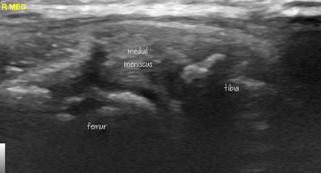 Meniscal extrusion in dogs: the sonographic perspective – Vet Practice ...