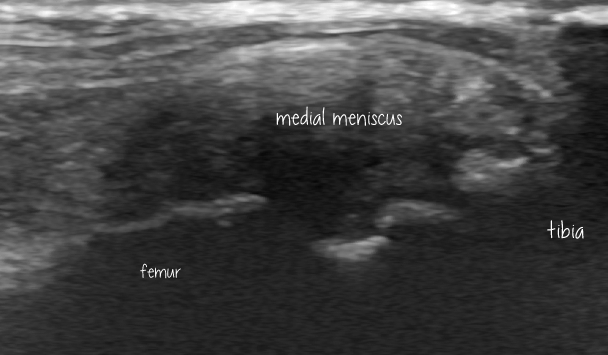 Meniscal extrusion in dogs: the sonographic perspective – Vet Practice ...