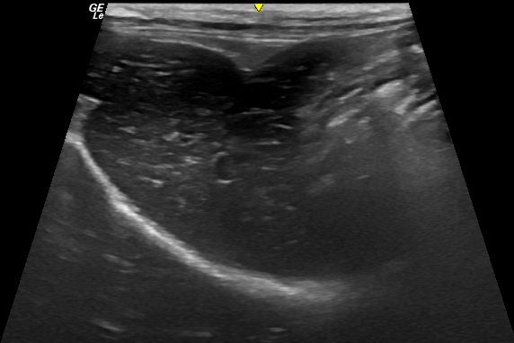 ‘Renal FIP’: sonographic features – Vet Practice Support