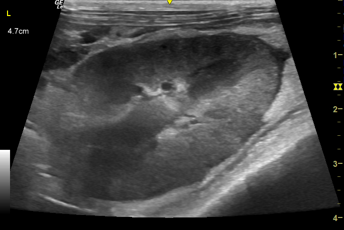 ‘Renal FIP’: sonographic features – Vet Practice Support