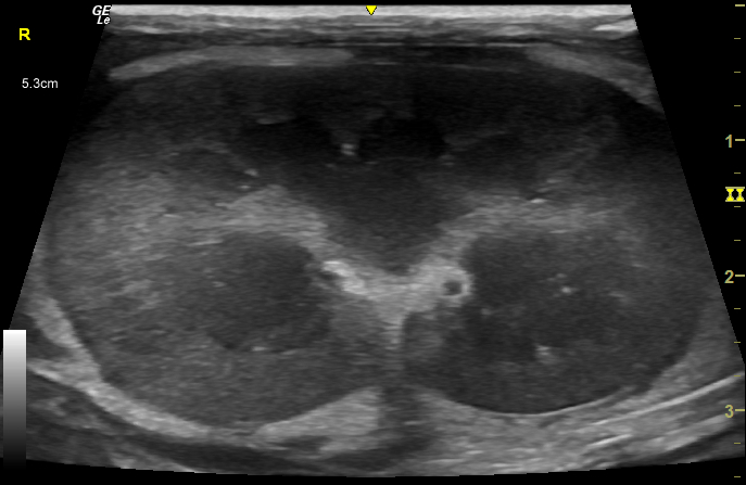 ‘Renal FIP’: sonographic features – Vet Practice Support