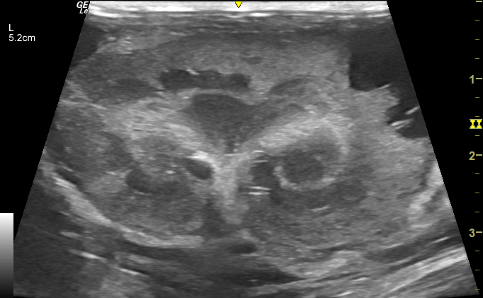 ‘Renal FIP’: sonographic features – Vet Practice Support