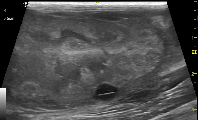 ‘Renal FIP’: sonographic features – Vet Practice Support