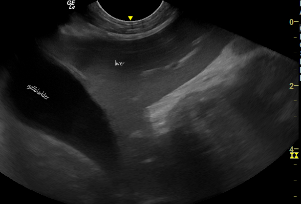 Putative Canine Toxic Shock Syndrome associated with Staphylococcus ...