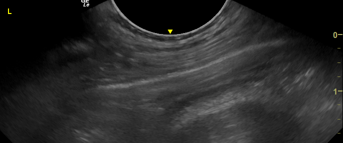 Putative Canine Toxic Shock Syndrome associated with Staphylococcus ...
