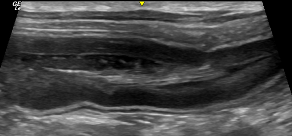 A case of canine dysautonomia: sonographic findings, apparent response ...
