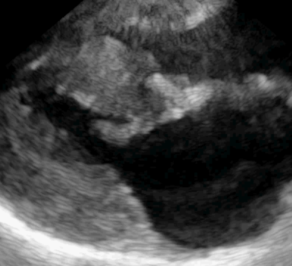 New study reveals that almost half of UK pet cats may develop HCM in ...