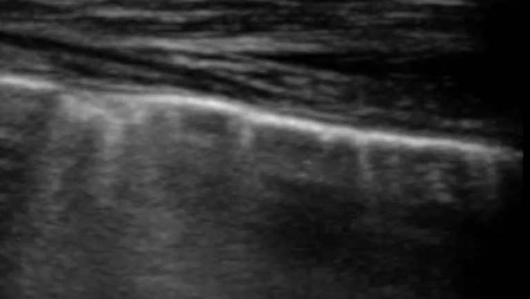 Lung ultrasound in cats and dogs: why does it get such a varied ...