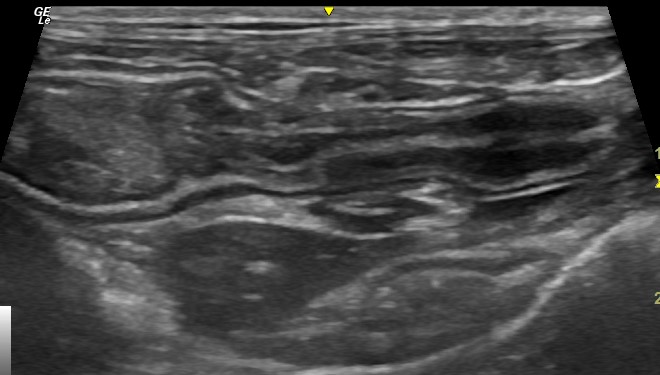 Practical small animal ultrasound bits and pieces: part I…linear ...