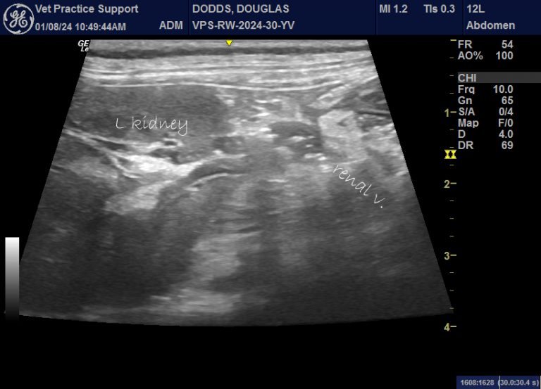 Septic thrombus of the renal vein and vena cava in a Pug dog with ...