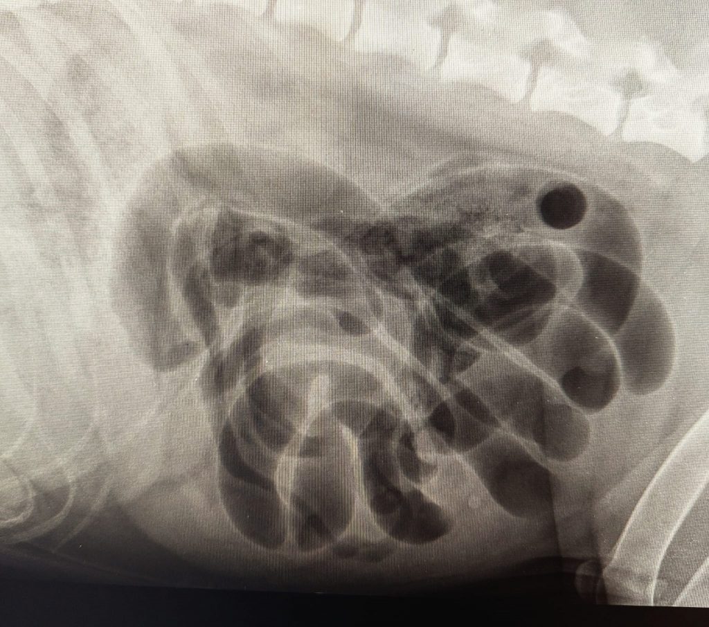 Oedema of the mesenteric root: a specific sign of mesenteric torsion ...
