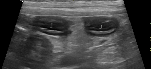 Enteritis after transiting foreign body in a dog – Vet Practice Support