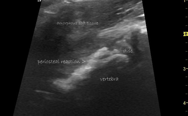 Sonographic features of bacterial discospondylitis in a dog – Vet ...